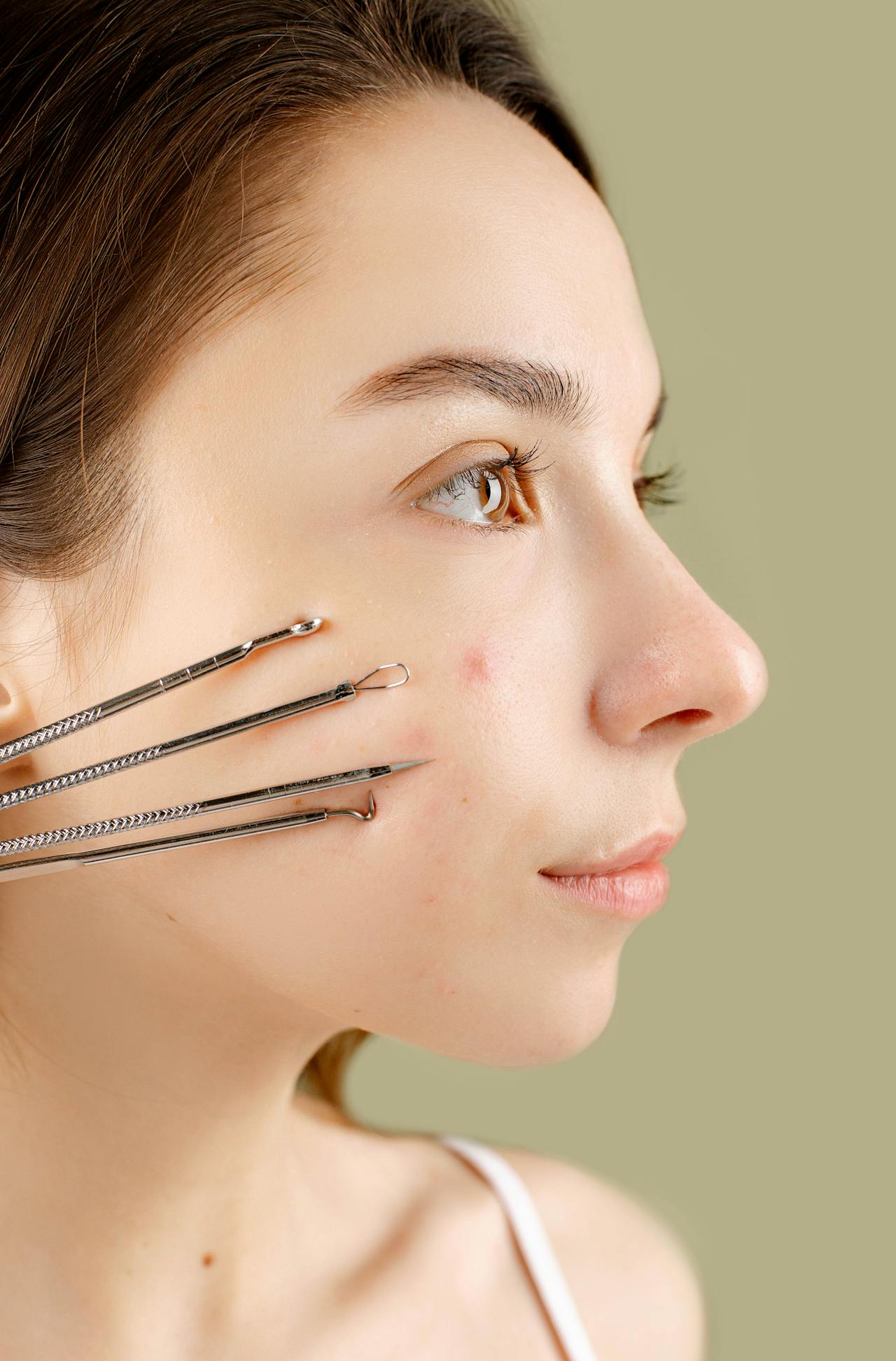 How To Get Rid Of Pimples Fast: The No Bullsh*t Guide